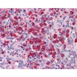ELANE / Neutrophil Elastase antibody