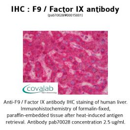 F9 / Factor IX antibody