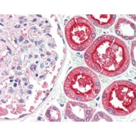 ACE-2 (Internal) antibody