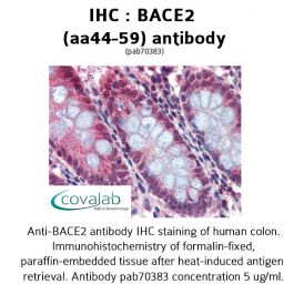 BACE2 (aa44-59) antibody