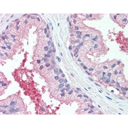 CADM2 (Extracellular Domain) antibody
