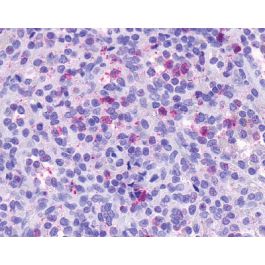 CCRL2 (Cytoplasmic Domain) antibody