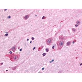 DRD1 / Dopamine Receptor D1 (Extracellular Domain) antibody