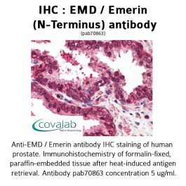 EMD / Emerin (N-Terminus) antibody