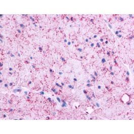 GPRC5C (Extracellular Domain) antibody