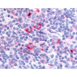 GPRC5D (Cytoplasmic Domain) antibody