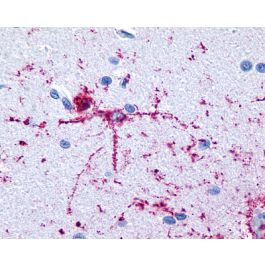GRM8 / MGLUR8 (N-Terminus) antibody