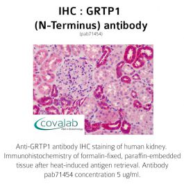 GRTP1 (N-Terminus) antibody