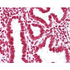 Histone H3 MeK9 antibody