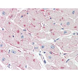 PNPLA2 / ATGL (Internal) antibody