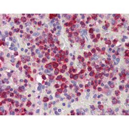 GZMB / Granzyme B (N-Terminus) antibody
