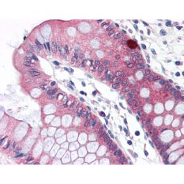 CLDN5 / Claudin 5 (C-Terminus) antibody