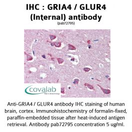 GRIA4 / GLUR4 (Internal) antibody