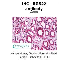 RGS22 antibody