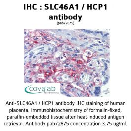 SLC46A1 / HCP1 antibody