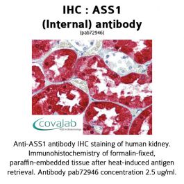 ASS1 (Internal) antibody