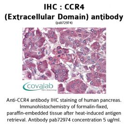 CCR4 (Extracellular Domain) antibody