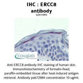 ERCC8 antibody