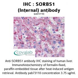 SORBS1 (Internal) antibody