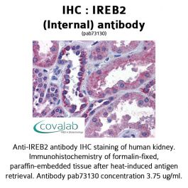 IREB2 (Internal) antibody