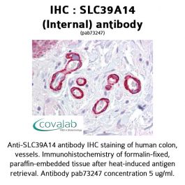 SLC39A14 (Internal) antibody