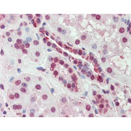 SLC44A2 (Internal) antibody