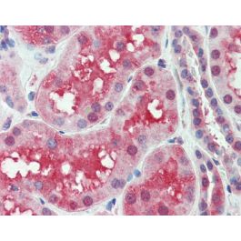 SLC44A2 (Internal) antibody