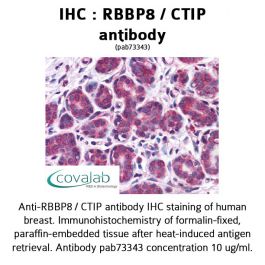 RBBP8 / CTIP antibody