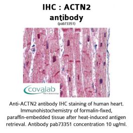 ACTN2 antibody