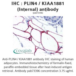 PLIN4 / KIAA1881 (Internal) antibody