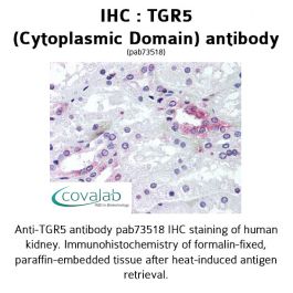 TGR5 (Cytoplasmic Domain) antibody