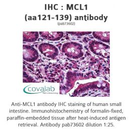 MCL1 (aa121-139) antibody