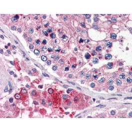 TMC6 (N-Terminus) antibody