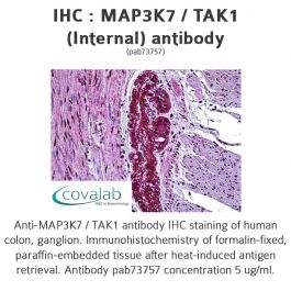 MAP3K7 / TAK1 (Internal) antibody