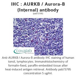 AURKB / Aurora-B (Internal) antibody