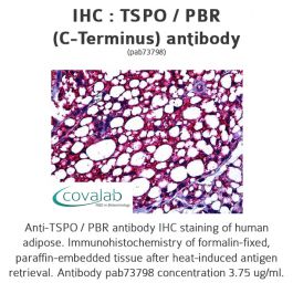 TSPO / PBR (C-Terminus) antibody