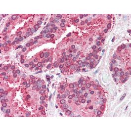 TSPAN6 (Internal) antibody