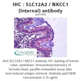 SLC12A2 / NKCC1 (Internal) antibody