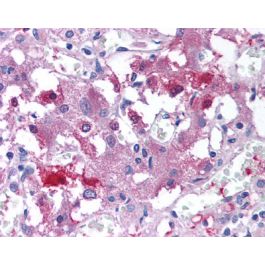 USP20 (Internal) antibody