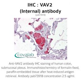 VAV2 (Internal) antibody
