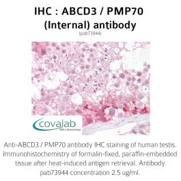 ABCD3 / PMP70 (Internal) antibody