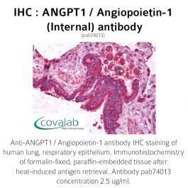 ANGPT1 / Angiopoietin-1 (Internal) antibody