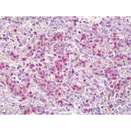 CSF2RB / CD131 (Internal) antibody