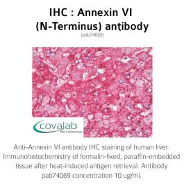 Annexin VI (N-Terminus) antibody
