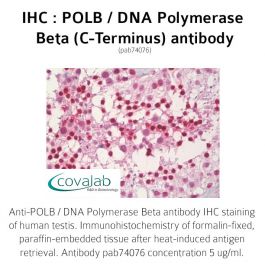 POLB / DNA Polymerase Beta (C-Terminus) antibody