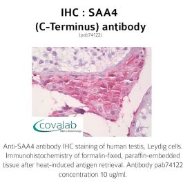 SAA4 (C-Terminus) antibody