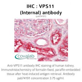 VPS11 (Internal) antibody