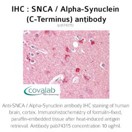 SNCA / Alpha-Synuclein (C-Terminus) antibody