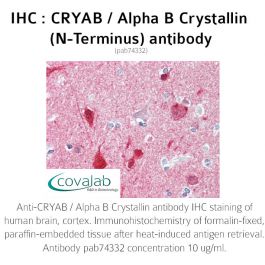 CRYAB / Alpha B Crystallin (N-Terminus) antibody