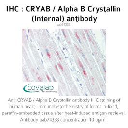 CRYAB / Alpha B Crystallin (Internal) antibody